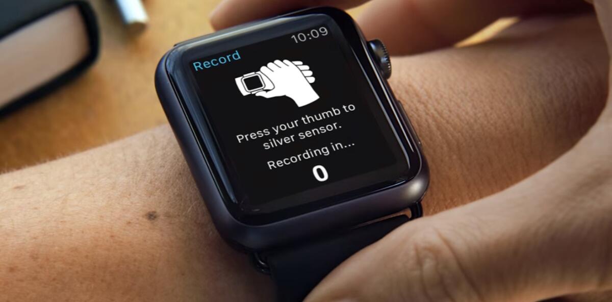 AliveCor-Armband für Apple Watch warnt vor Herzinfarkt | Mac Life